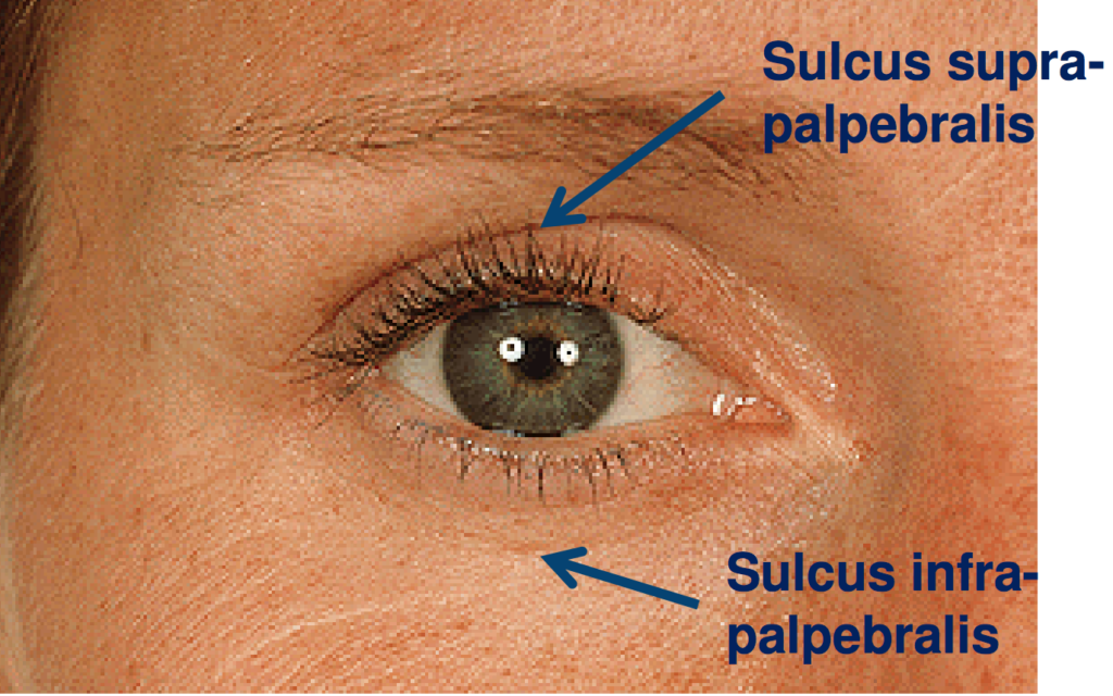 Sulcus suprapalpebralis - Medicin.wiki